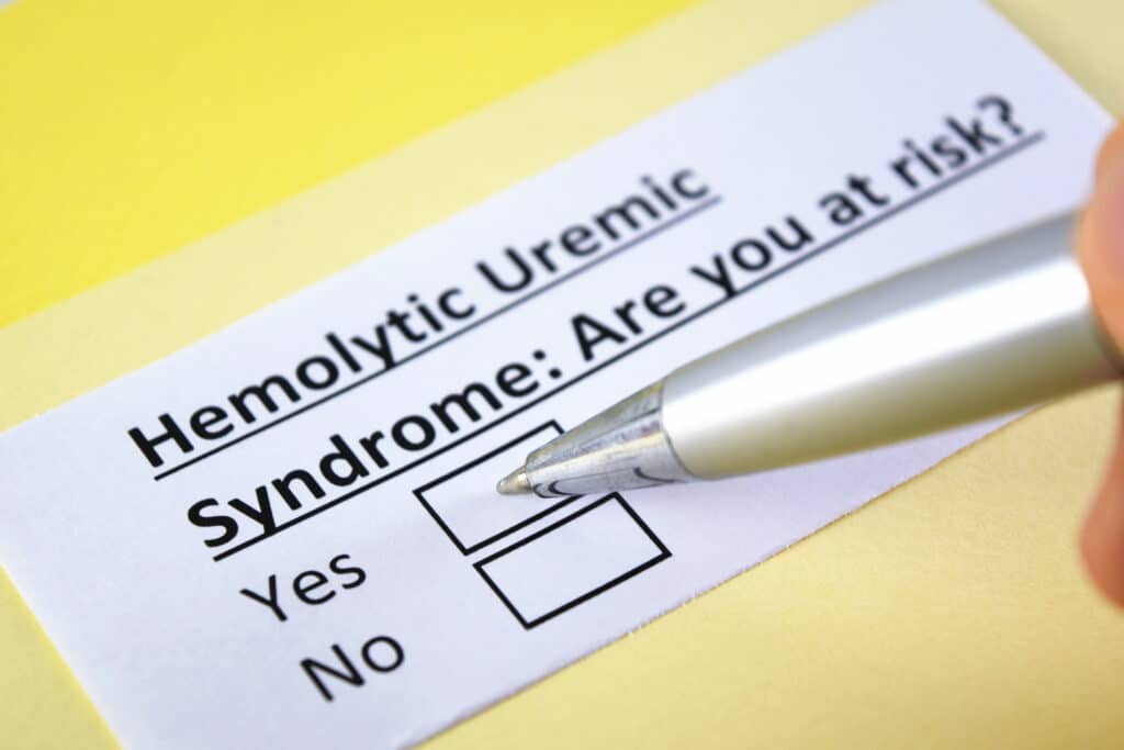 Analysis of Hemolytic Uremic Syndrome (HUS), Including Shiga toxin ...