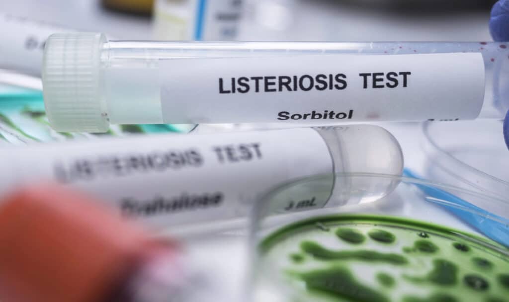 Interesting New Research into Listeria Monocytogenes - The Deadly food ...